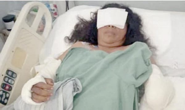 ¡MARATONISTA ISIDRA TORRES MUERE TRAS SER ATACADA POR PERROS PITBULL EN OAXACA!